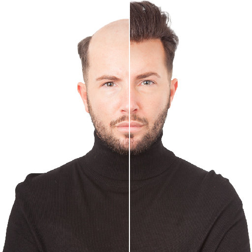 Bespoke Hair Systems, Wigs, Hair Pieces & Toupees | hair4alluk